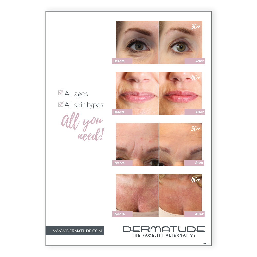 Poster Foam Board Before/After (42x29 cm) (Out of Stock) – Dermatude ...